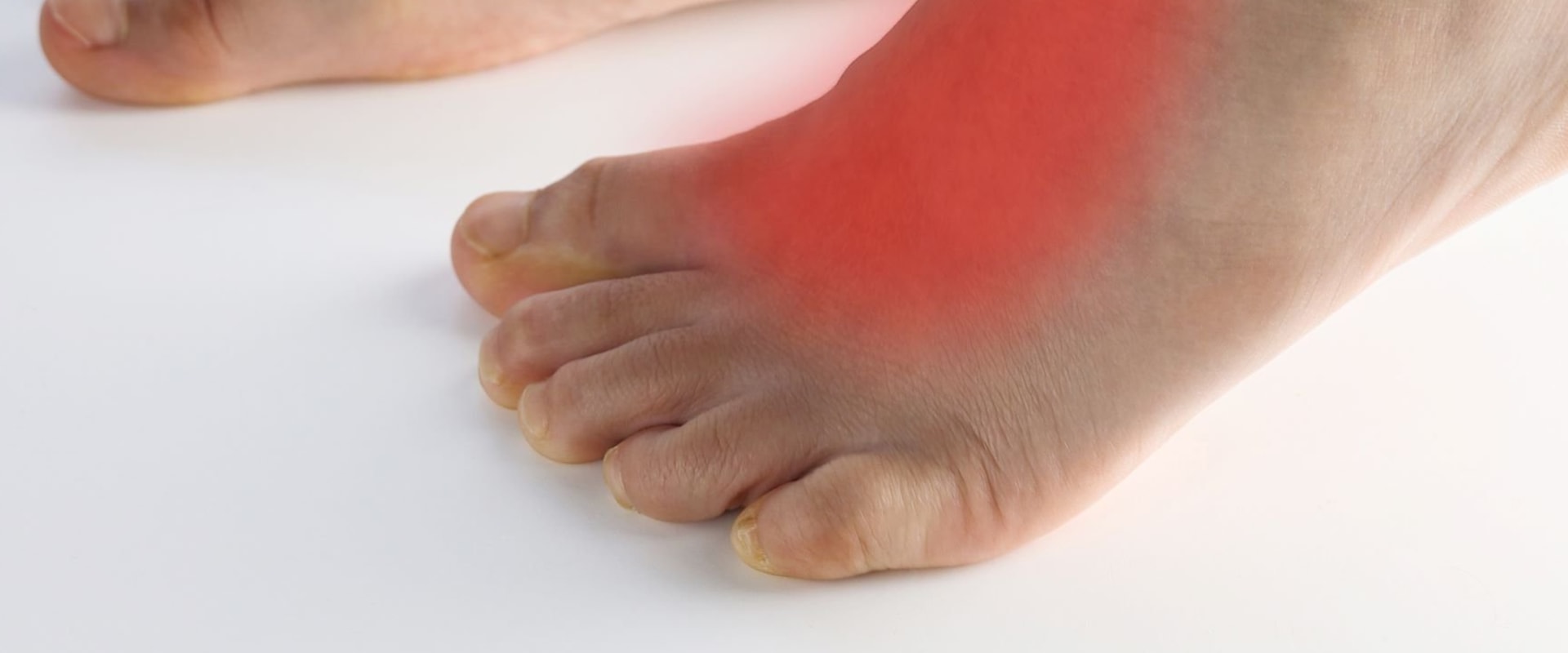 Foot-problems